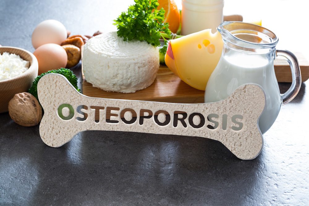 8 Tips for Preventing and Treating Osteoporosis - Alex Danea - Licensed ...